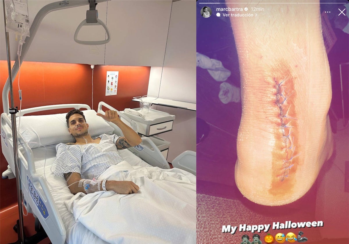 betis: Bartra muestra la cicatriz tras su operación: «My happy Halloween» betis: Bartra muestra la cicatriz tras su operación: «My happy Halloween»
