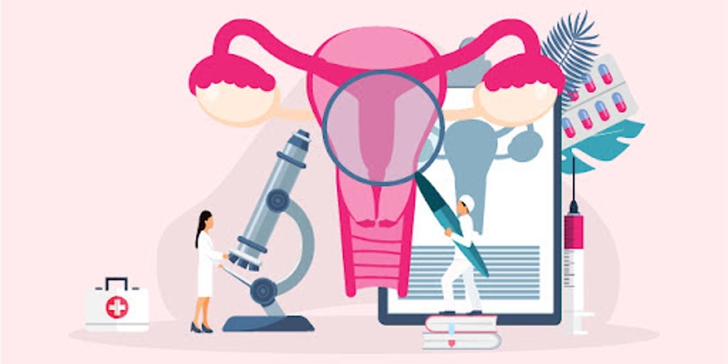 ¿Por qué es tan importante la citología en la detección temprana de ...