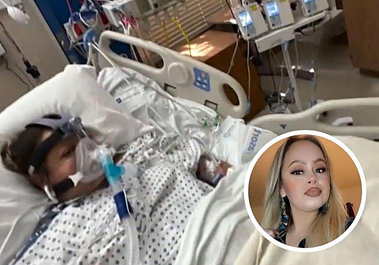 Le amputan todas las extremidades a una mujer tras comer un pescado en ...