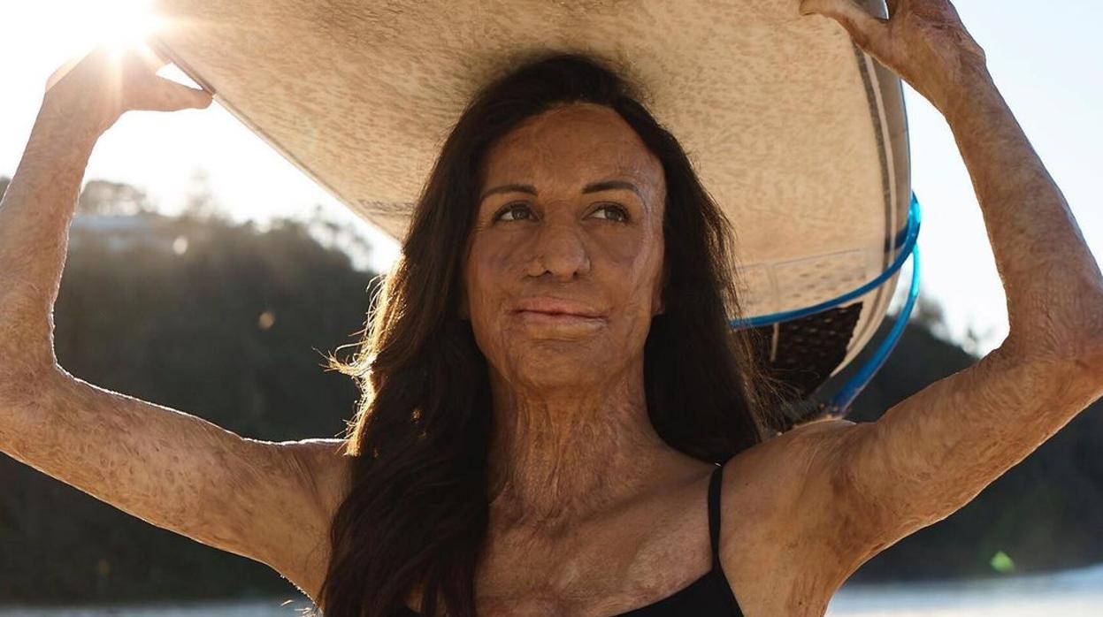 Turia Pitt: «En lugar de obsesionarme con lo que me pasó, dirigí mi ...